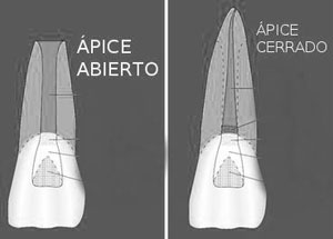 Prevención - Cuidado Dental Personalizado